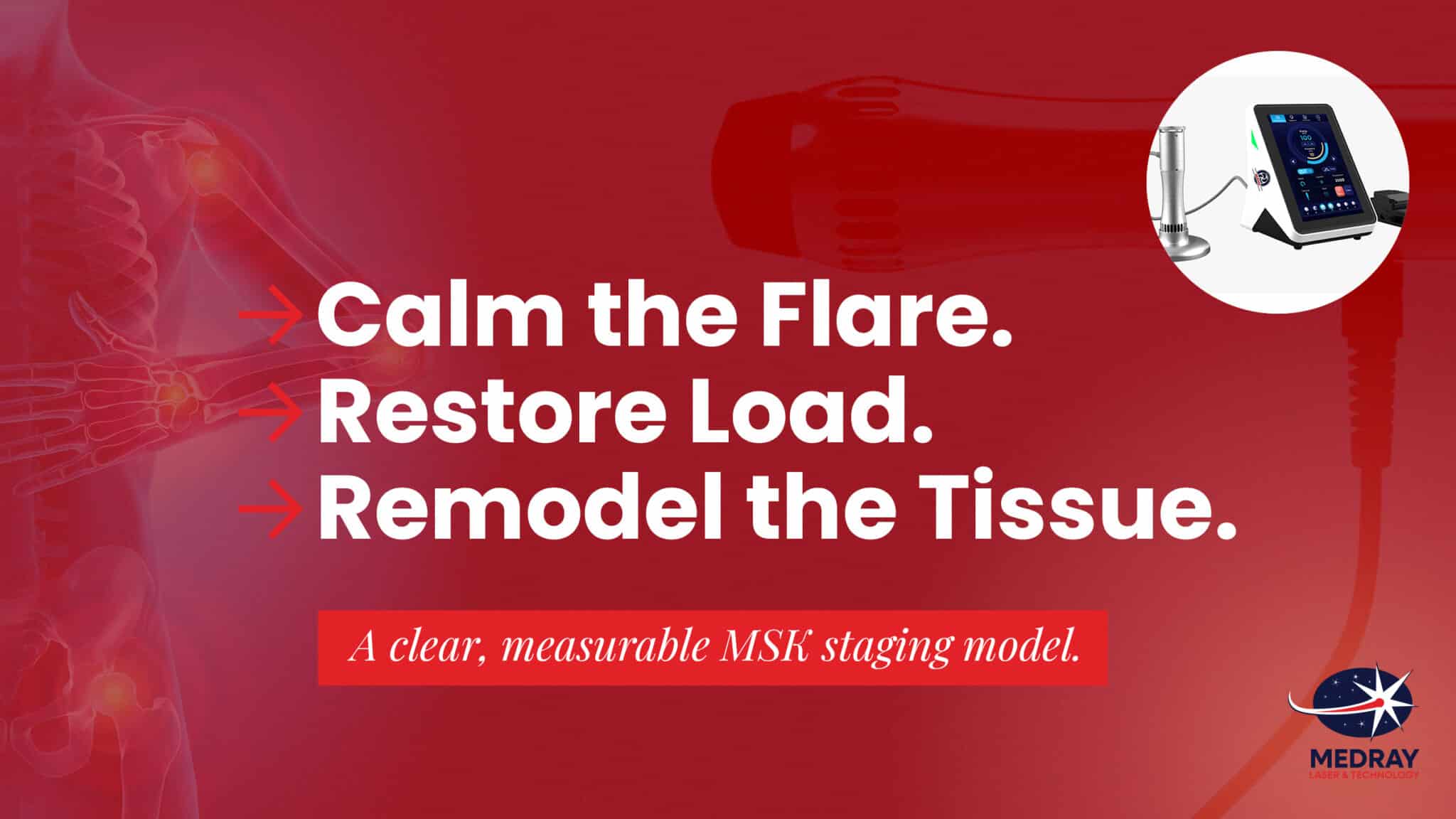 Clinical Staging at the Pathology Site | PBM to Shockwave Pathway